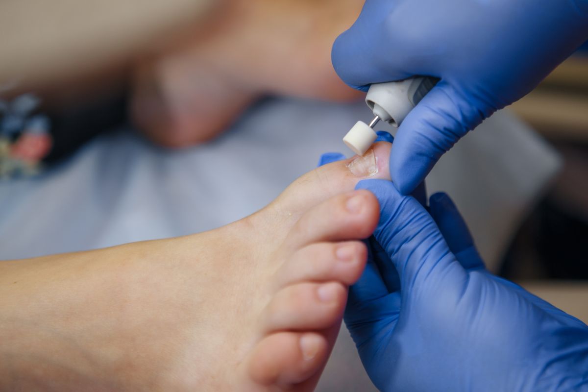 Help for Smelly Feet: When to See a Podiatrist
