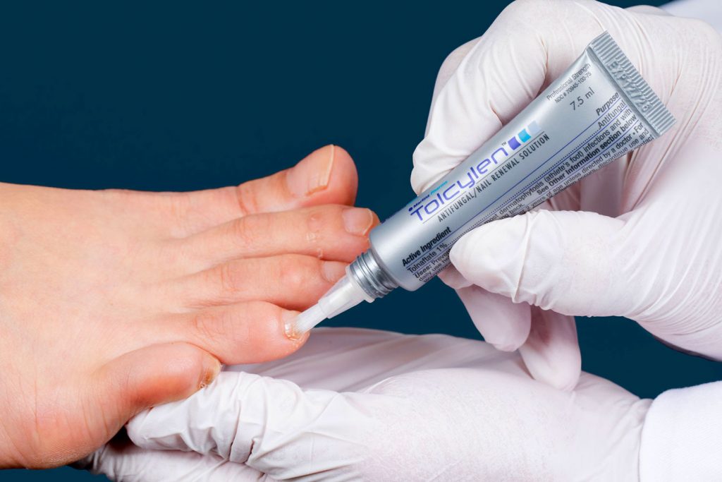 Antifungal/Nail Renewal Solution | The Foot & Ankle Clinic